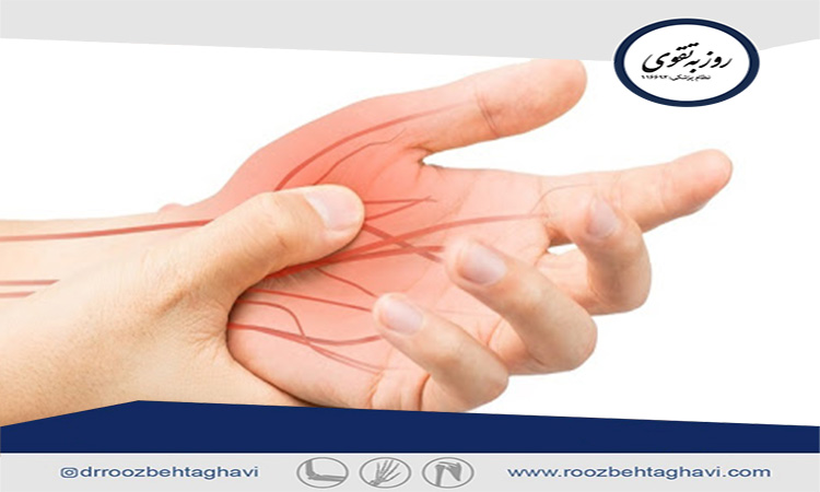 آشنایی با تاندون دست - درمان تاندون دست - دکتر تقوی فوق تخصص جراحی دست